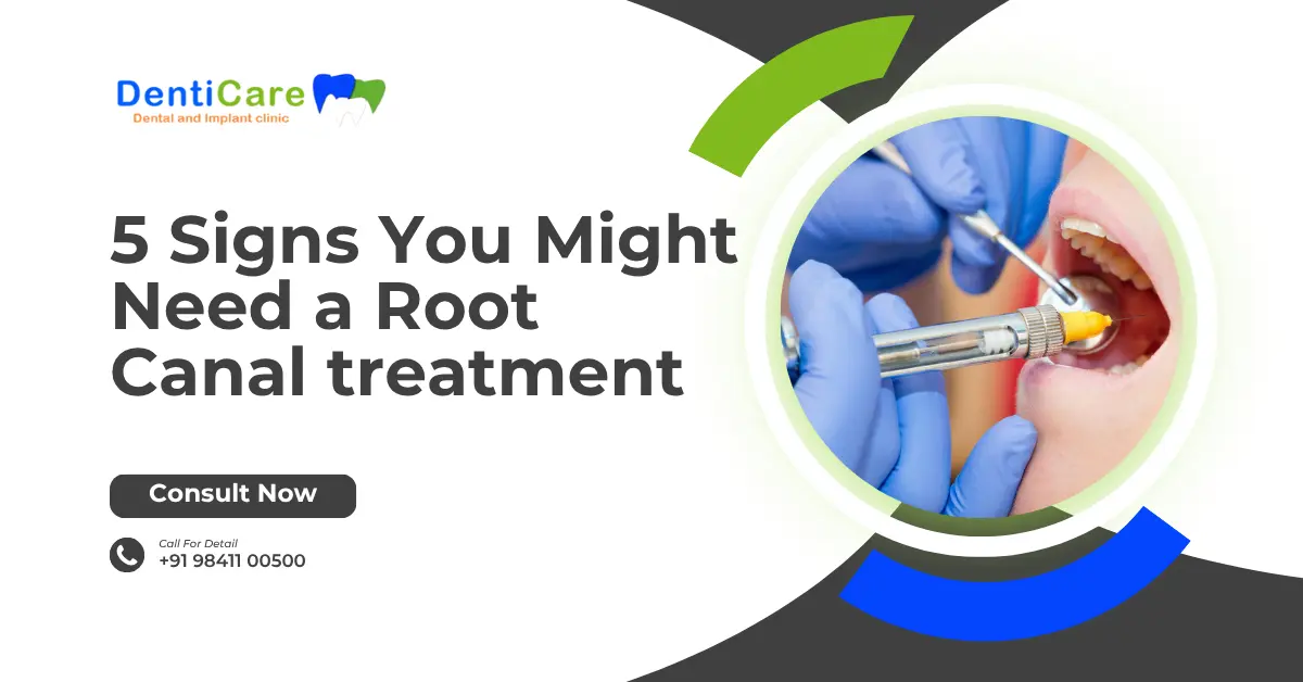 5 Powerful Signs You Might Need Root Canal Treatment